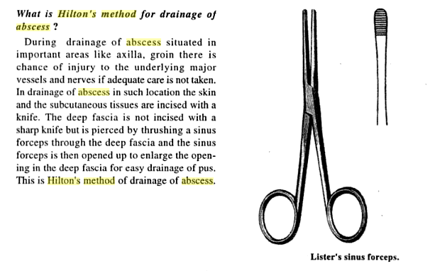 Medicine Decoded: Hilton’s method to drain abscesses.